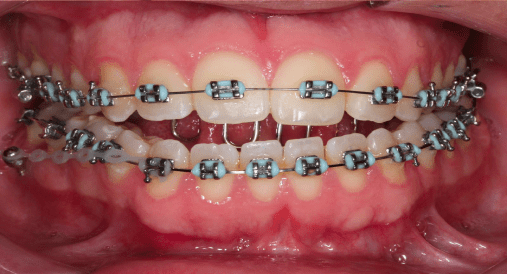 Servicios dentales hispanos